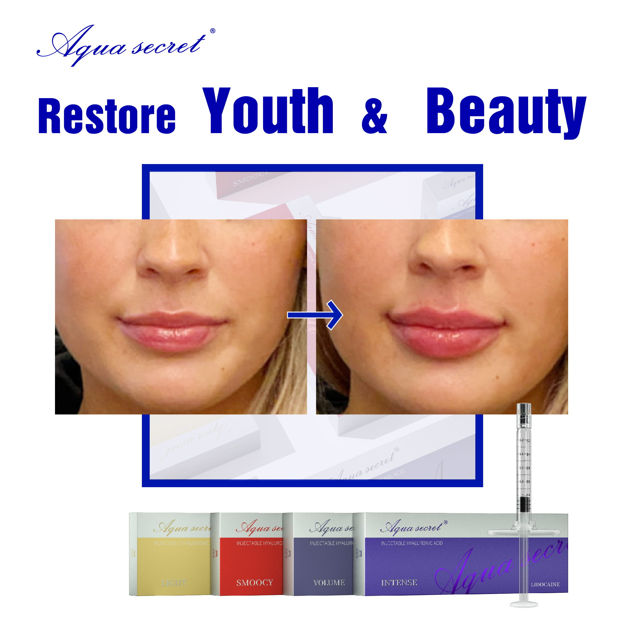 Upper Lip Filler Price: A Comprehensive Guide - Dermax