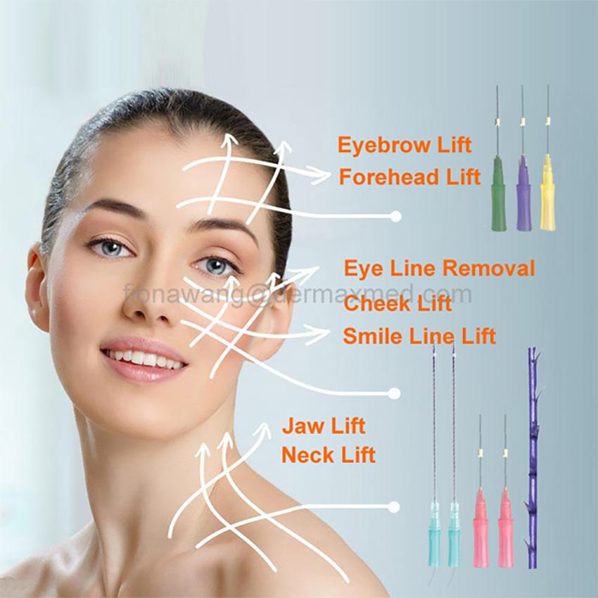 Non-surgical Facial Pdo Thread - Dermax
