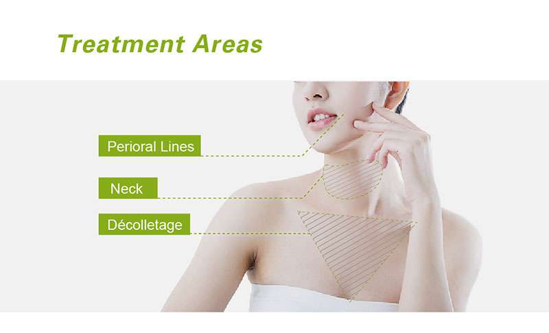 NutriDerm® Hylite best skin booster for neck - Dermax Medical