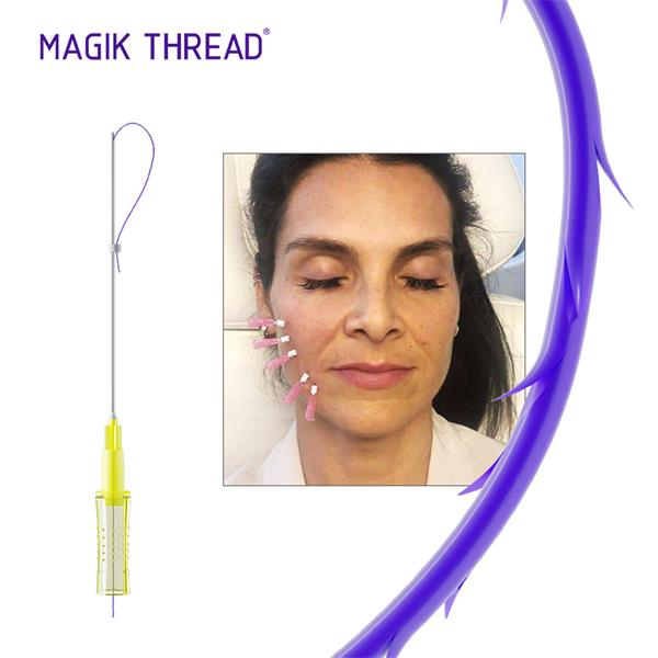 China pdo thread lift cheeks manufacturers, pdo thread lift cheeks ...