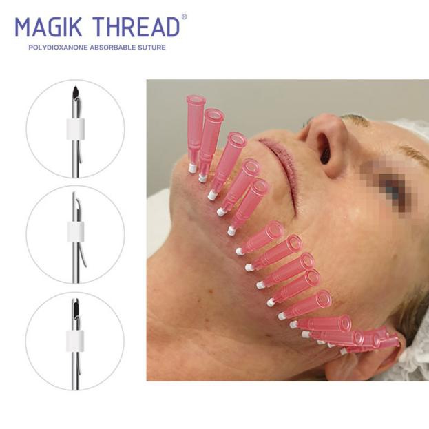 What are the advantages of a thread lift? - Dermax