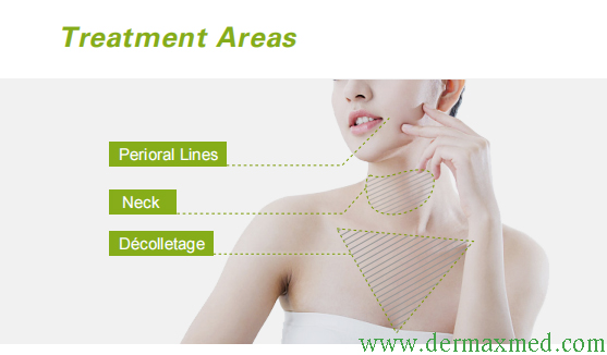 Skin Booster Injection For Perilral Lines - Dermax