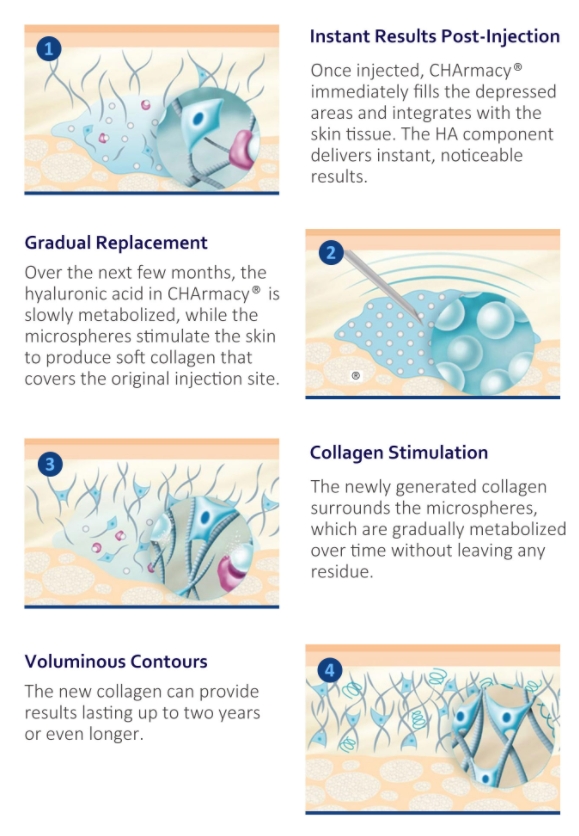 What Is Calcium Hydroxylapatite Injection? - Dermax