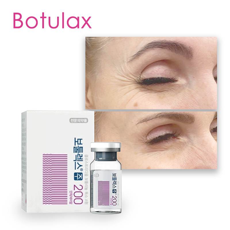 Botulax VS Sotorior Botulinum Toxin- Dermax