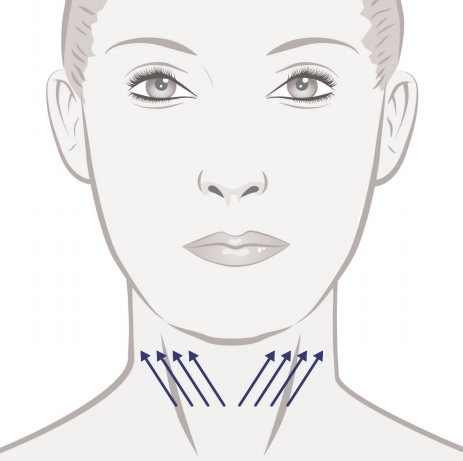 Pdo Thread Neck Lift, Buy Pdo Thread Neck Lift, Pdo Thread Neck Liftfor ...