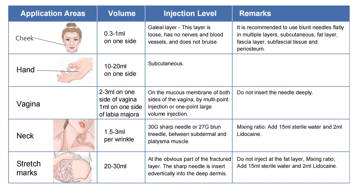 Devolux Plus Filler 160mg/Vial Plla Dermal Filler, Dermax