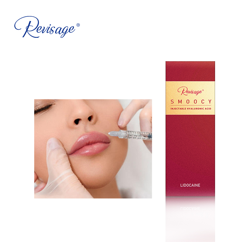 Revisage Filler Smoocy 1 ml Lip Filler Price - Dermax