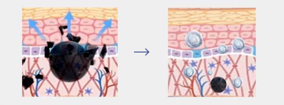EXOBLOOM Exosome Injection For Face - Dermax