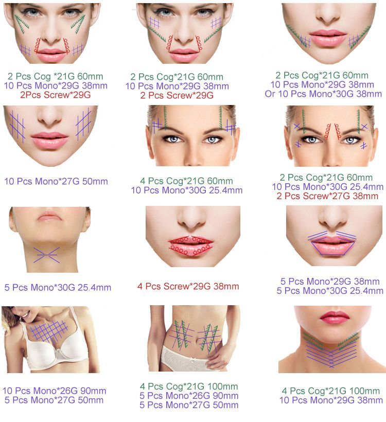 Magik PDO Thread - Dermax