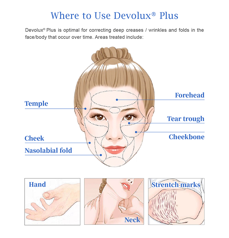 Devolux Plus Filler 160mg/Vial Plla Dermal Filler, Dermax