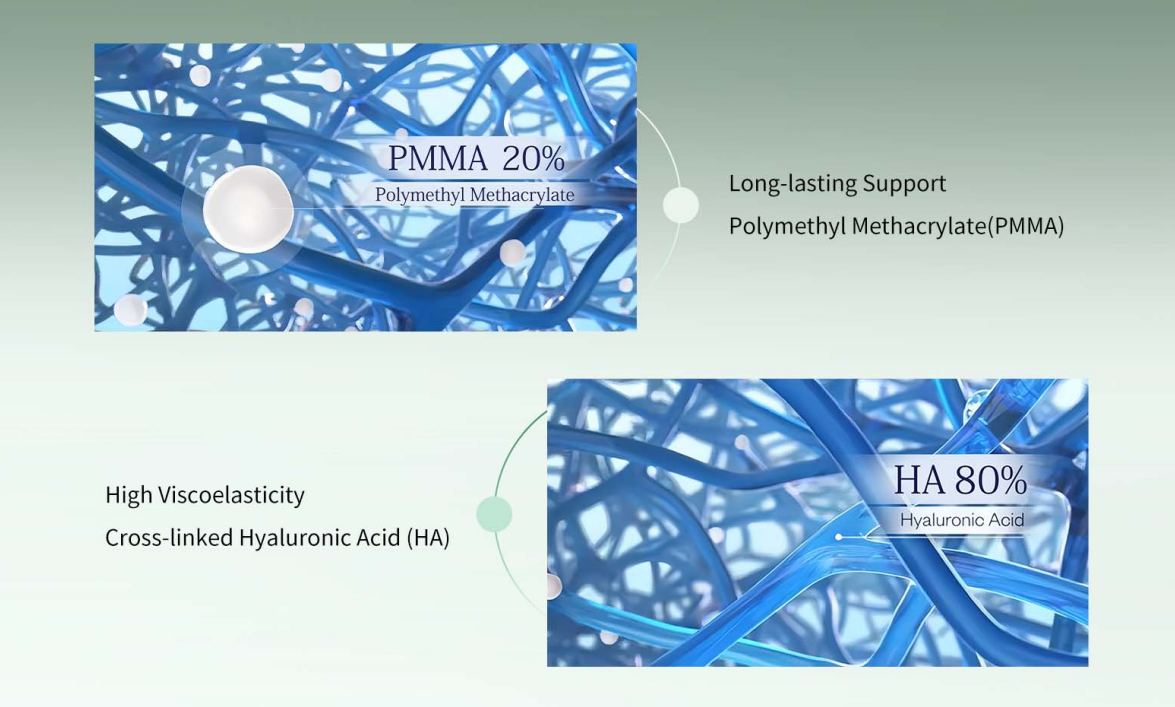 PMMA Injections Cost: Affordable Alternatives and Superior Results - Dermax