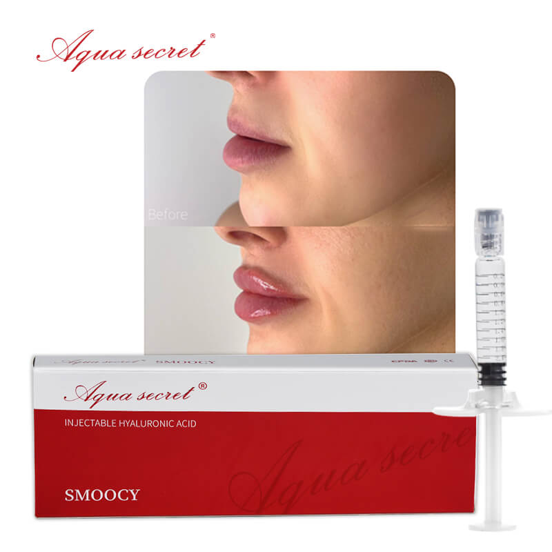 Lip Filler Before and After Photos | Transformative Lip Enhancement ...