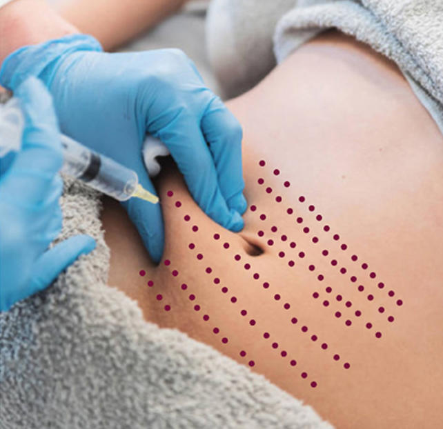 Abdominal Fat Dissolving Injections: Complete Guide